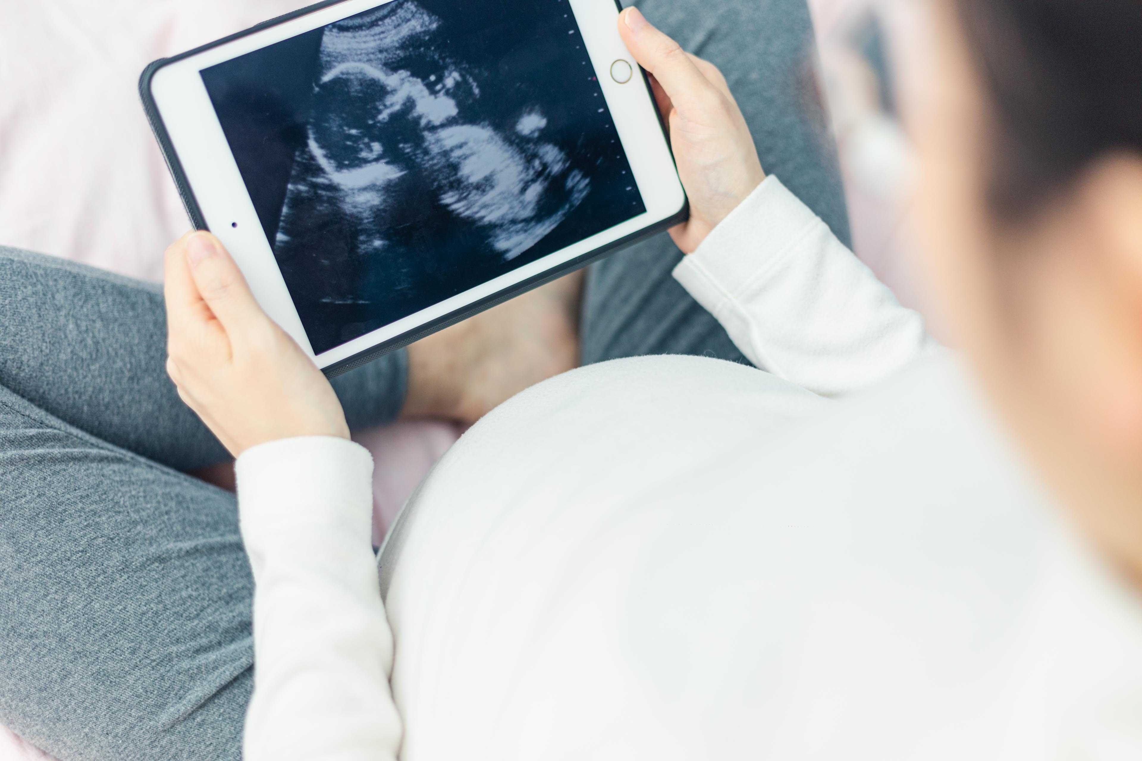 Qué tomar para el reflujo en el embarazo | Gaviscon